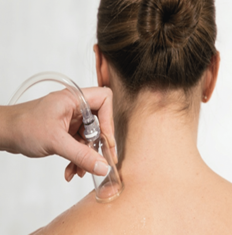 Storz Medical | Shockwave Canada